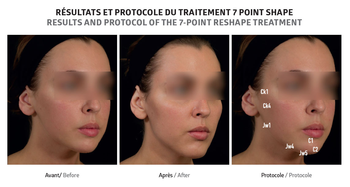 LE 7 POINT SHAPE - Anti Age Magazine